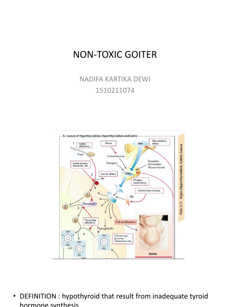 Non-Toxic Goiter New | PDF | Self-Improvement | Wellness