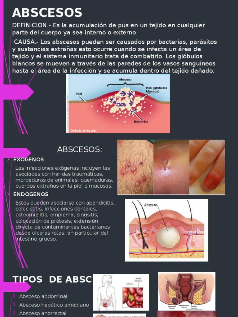 ABSCESOS | PDF | Staphylococcus Aureus | Estreptococo