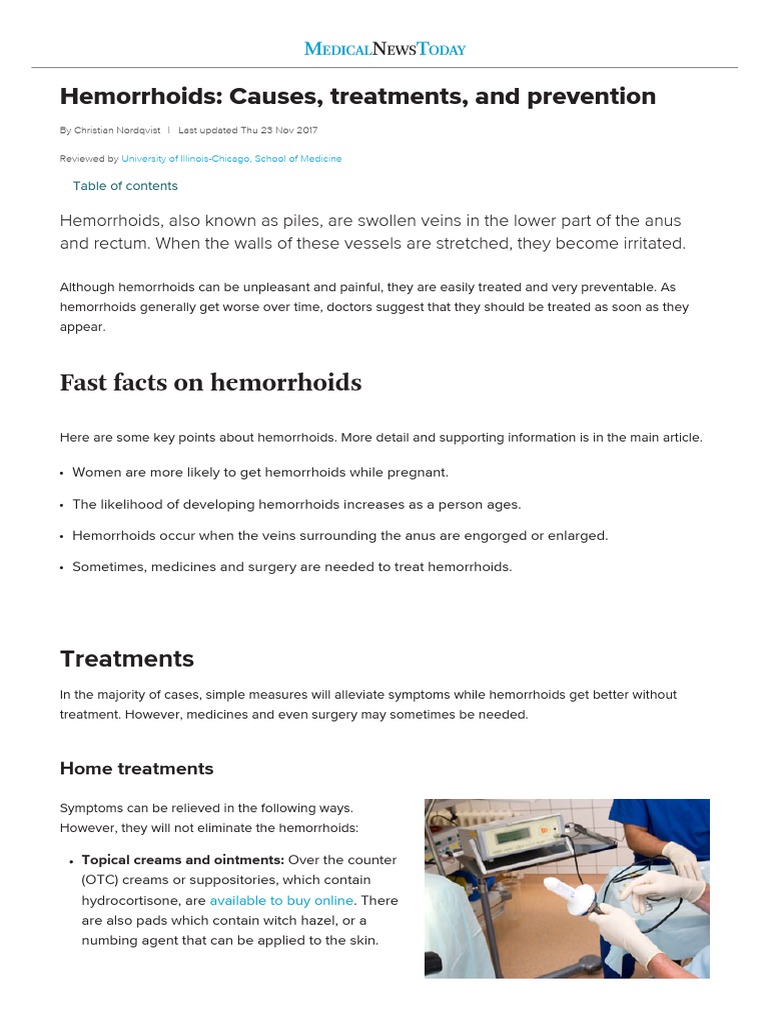 Hemorrhoids Causes Treatments And Prevention Pdf Hemorrhoid