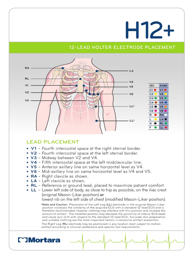 ECG Holter H12+ | PDF | Electrocardiography | Medical Specialties
