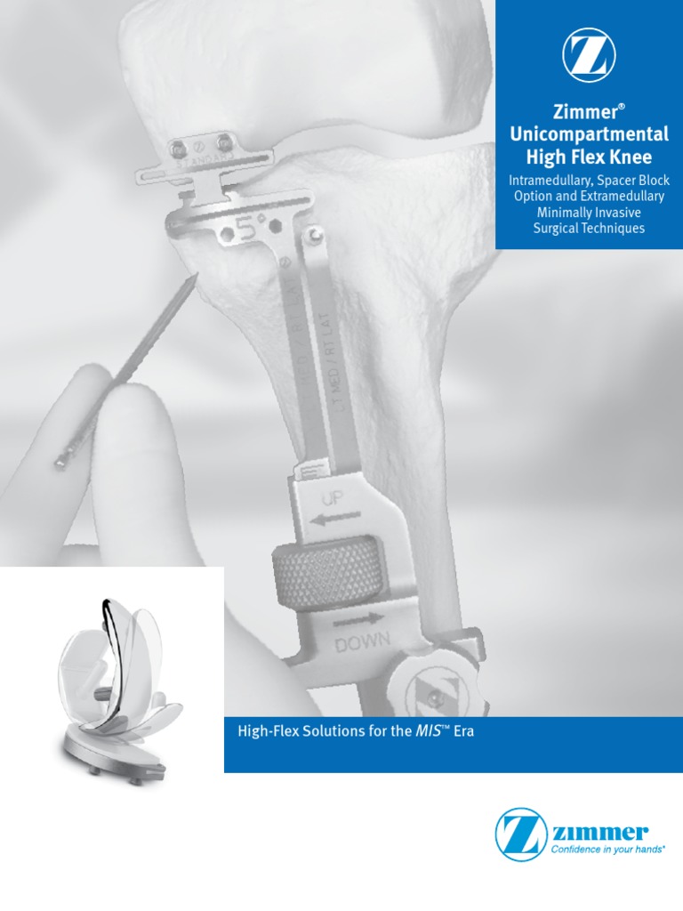Zimmer® Unicompartmental High Flex Knee | PDF | Knee | Lower Limb Anatomy
