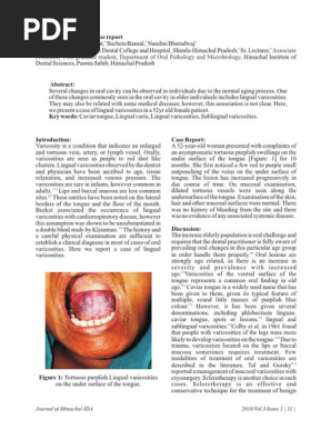 Lingual Varicosities