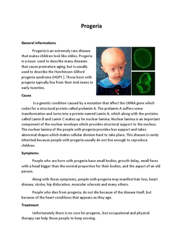 Progeria: General Informations | PDF | Health Sciences | Diseases And ...