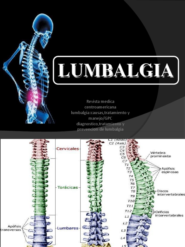 LUMBALGIA | PDF | Dolor lumbar | Sistema musculoesquelético