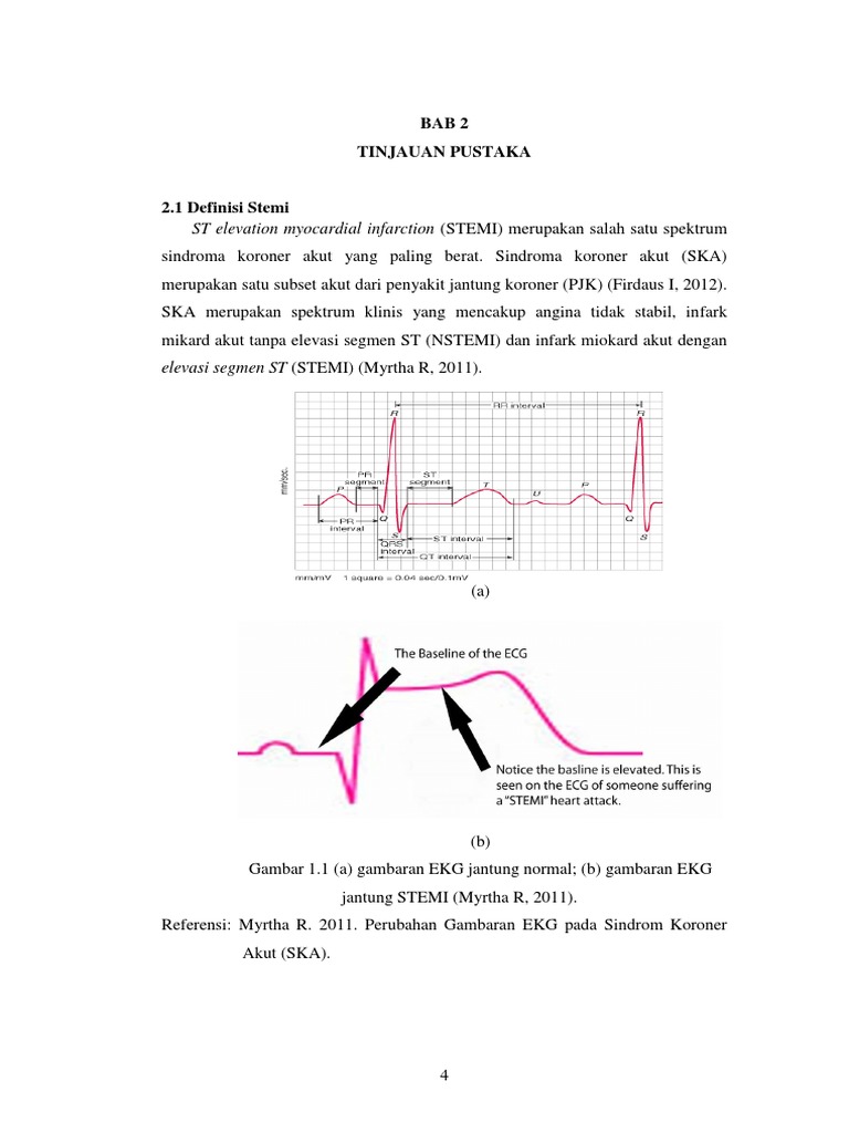 Bab 2 LP Stemi | PDF