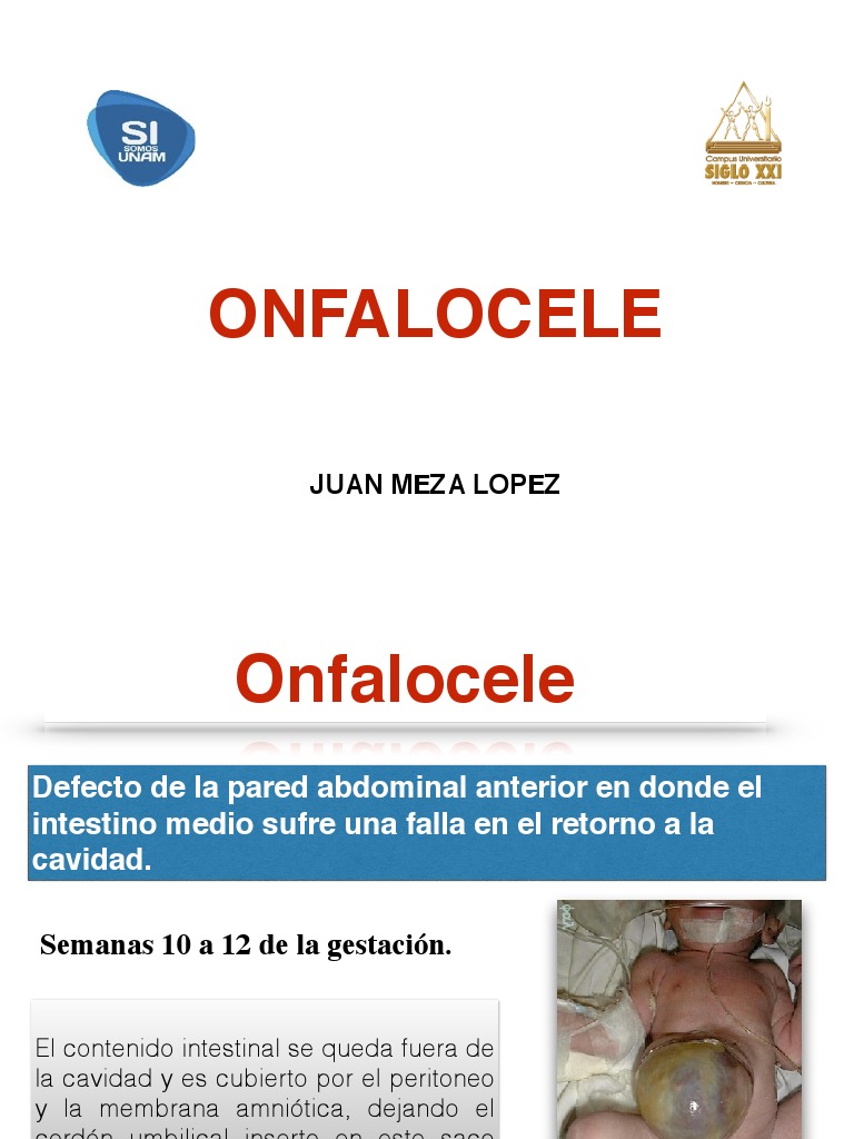 Onfalocele y Gastrosquisis | PDF | El embarazo | Abdomen