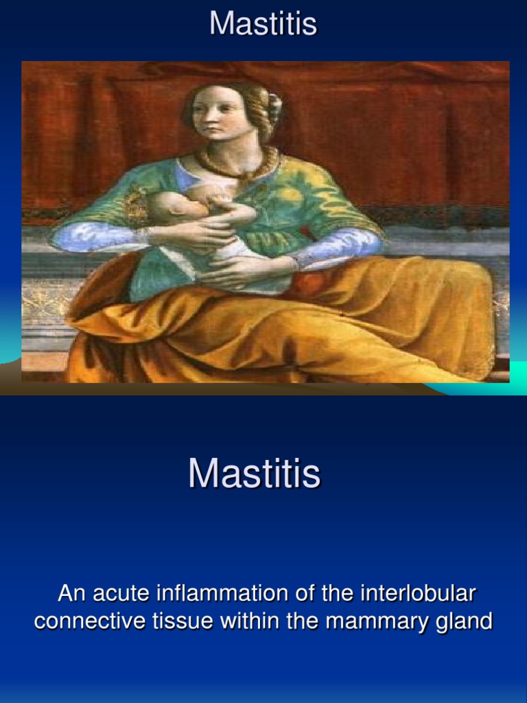 Mastitis | PDF | Breast Cancer | Public Health