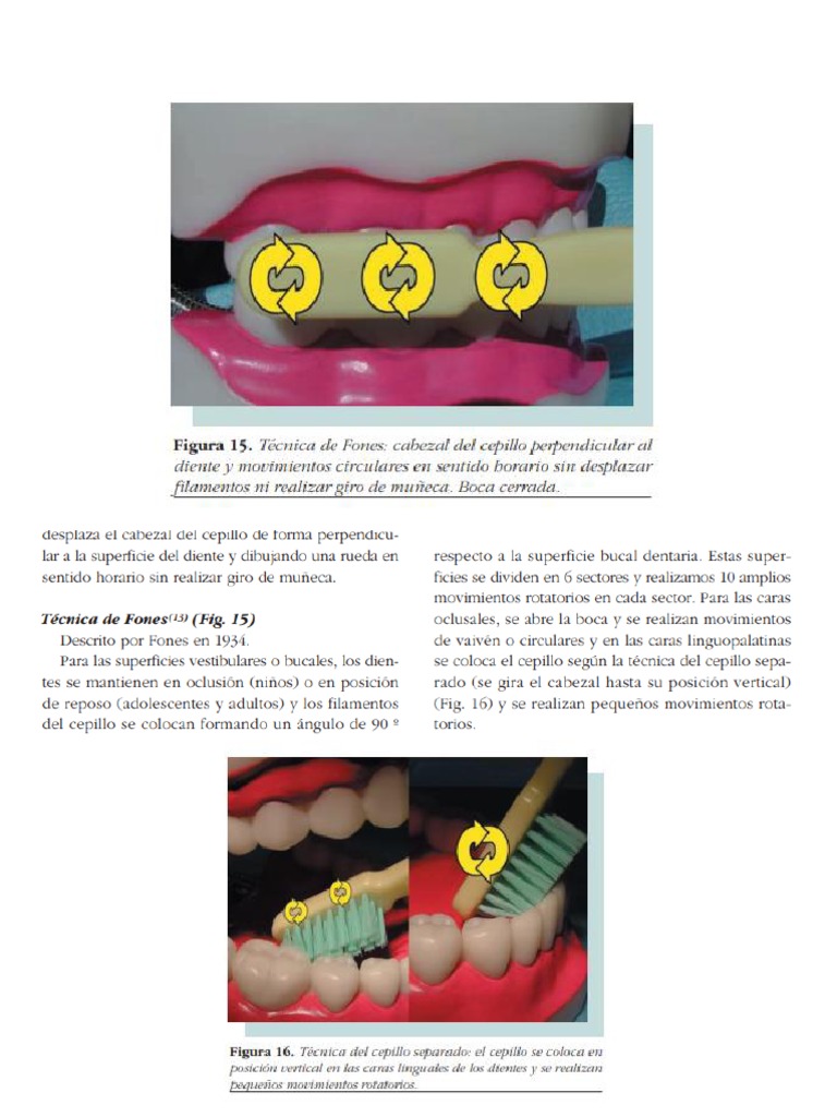 Tecnica de Fones | PDF