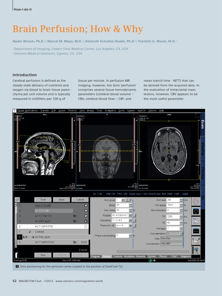 Brain Perfusion How Why-00093544 | PDF | Magnetic Resonance Imaging ...
