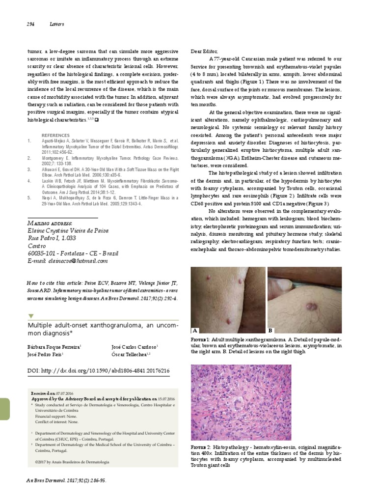 Xantho | PDF | Neoplasms | Pathology