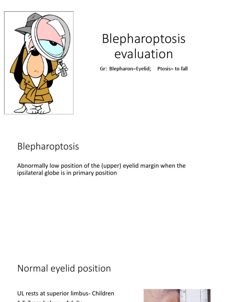 Blepharoptosis Evaluation: GR: Blepharon Eyelid Ptosis To Fall | PDF