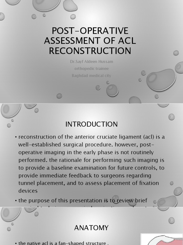Post-Operative Assessment of Acl Reconstruction: DR - Sayf Aldeen ...