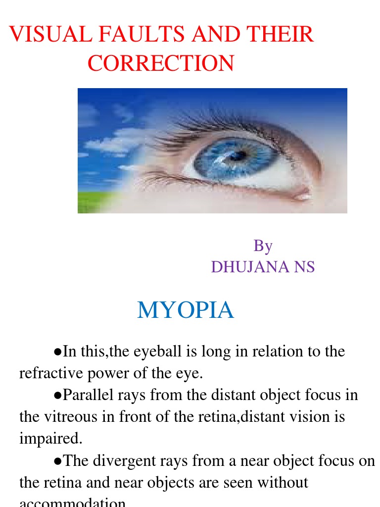 Visual Faults and Their Correction: by Dhujana Ns | PDF | Human Eye | Eye