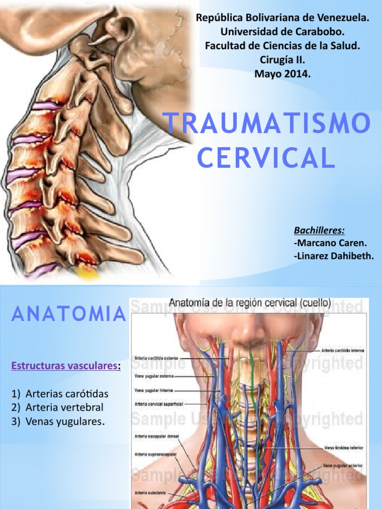 Traumatismo Cervical | PDF | Lesión | Lesión de la médula espinal