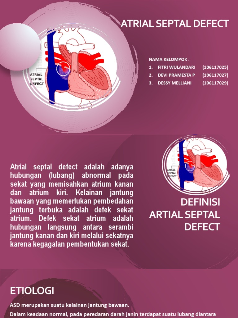 Definisi dan Penanganan ASD Jantung | PDF | Sains & Matematika