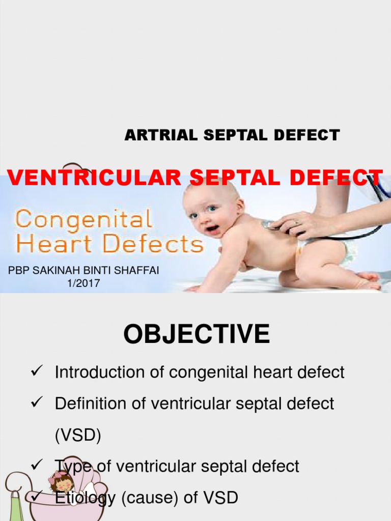 Comprehensive overview of ventricular septal defect: Types, causes ...