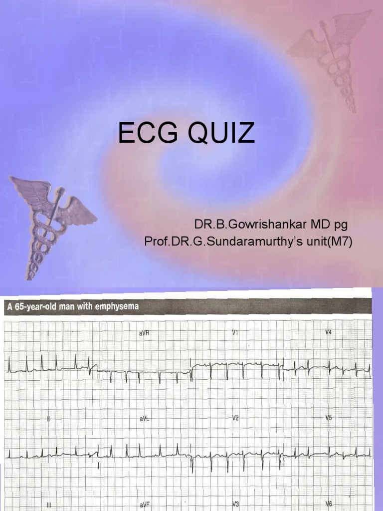 ECG Quiz 1 | PDF | Electrocardiography | Physiology