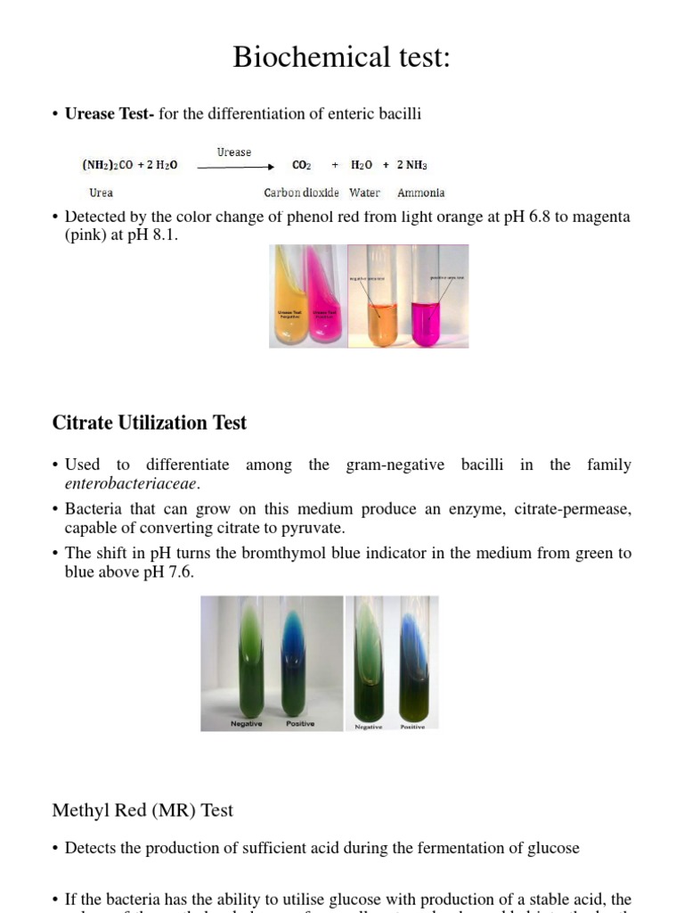 Biochemical Test:: - Urease Test-For The Differentiation of Enteric ...