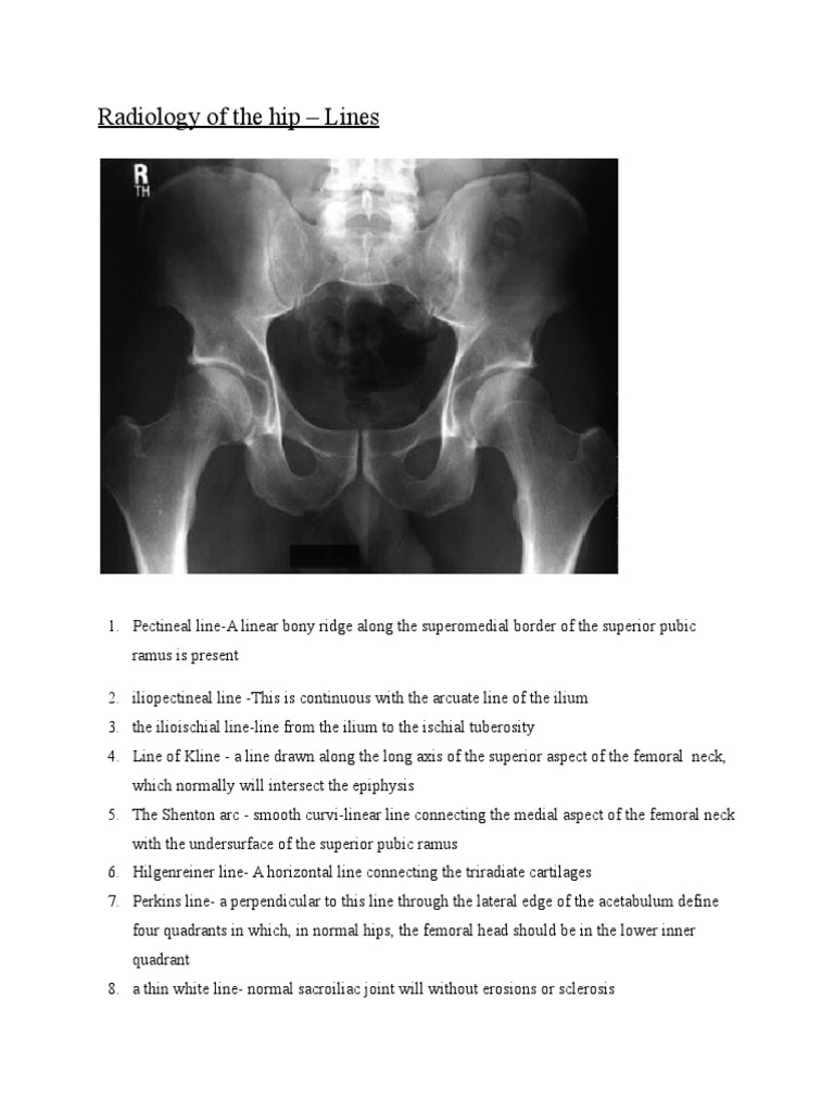 Radiology of The Hip - Lines | PDF | Hip | Pelvis