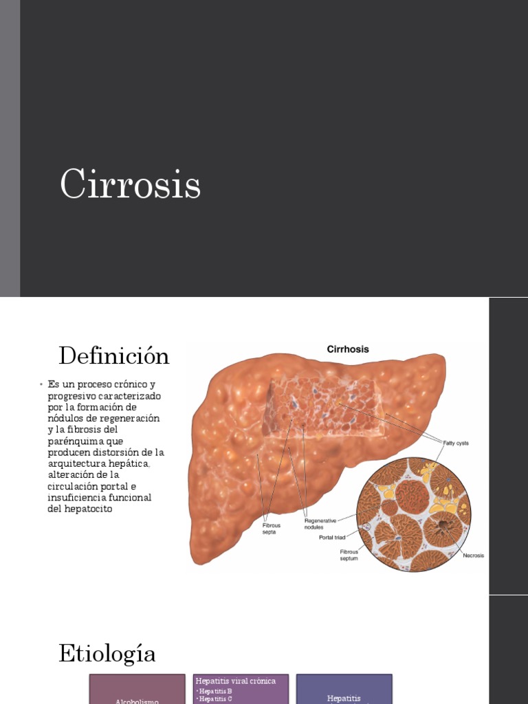Cirrosis | PDF | Cirrosis | Hepatitis