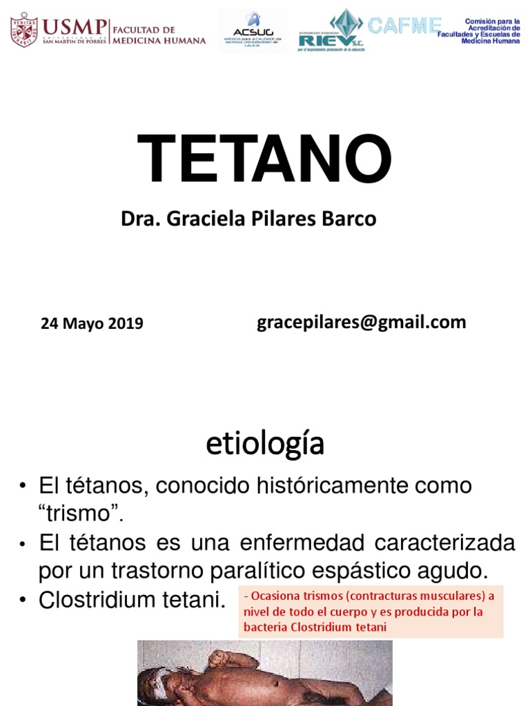 Tetano | PDF | Especialidades Medicas | Medicina CLINICA