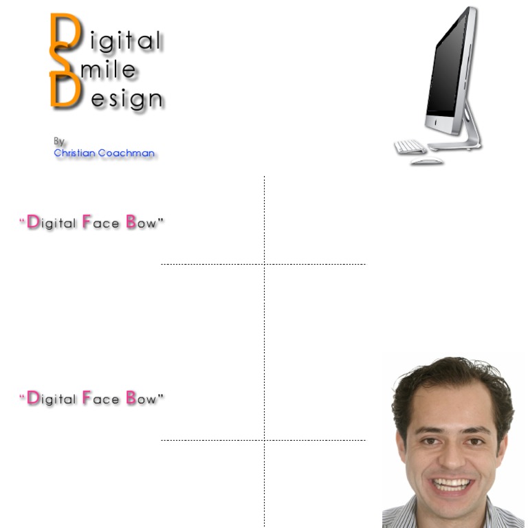 DSD Model Transfer | Length