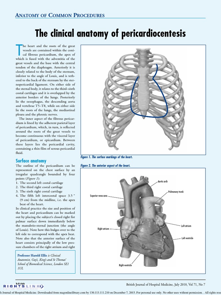 The Clinical Anatomy of Pericardiocentesis: Natomy of Ommon Rocedures ...