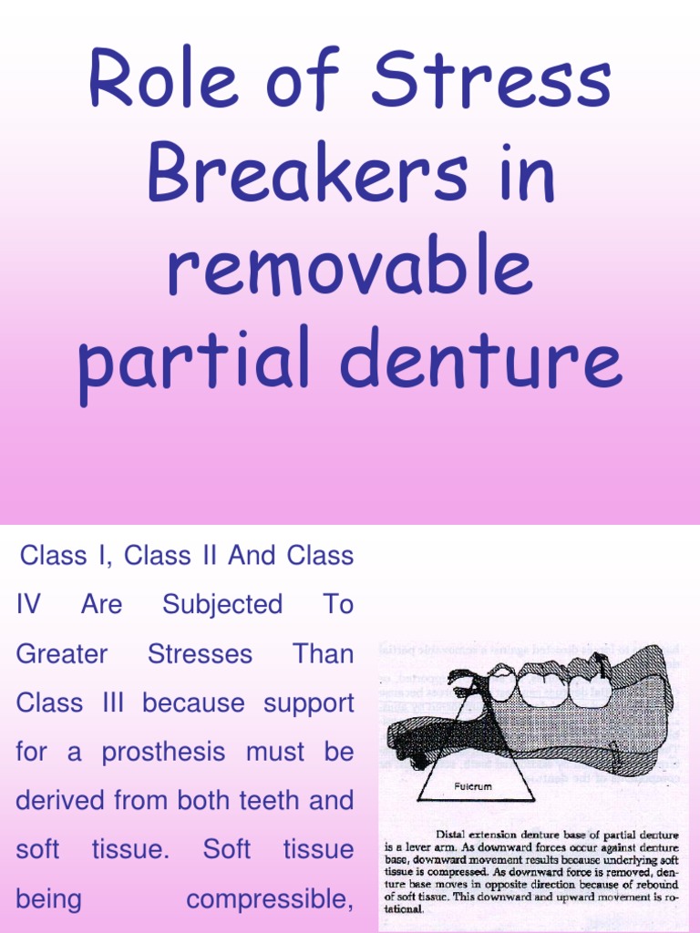 Role of Stress Breakers in Removable Partial Denture | PDF | Dentures ...