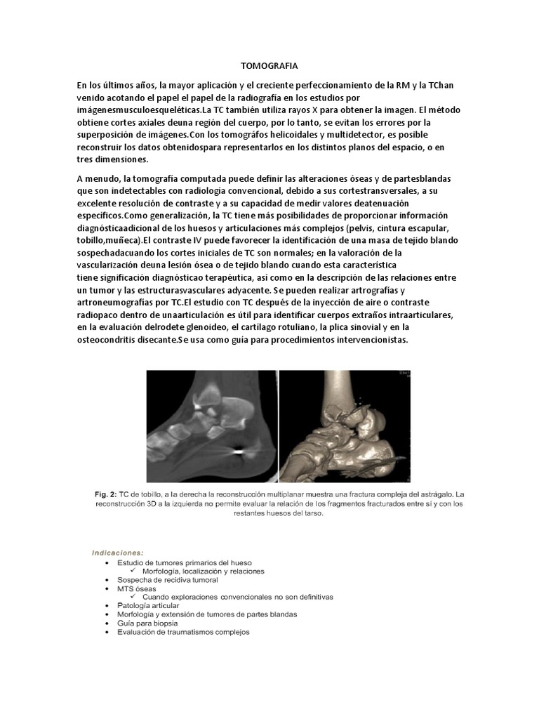 Tomografía Computada del Húmero | PDF | Ct Scan | Medicina