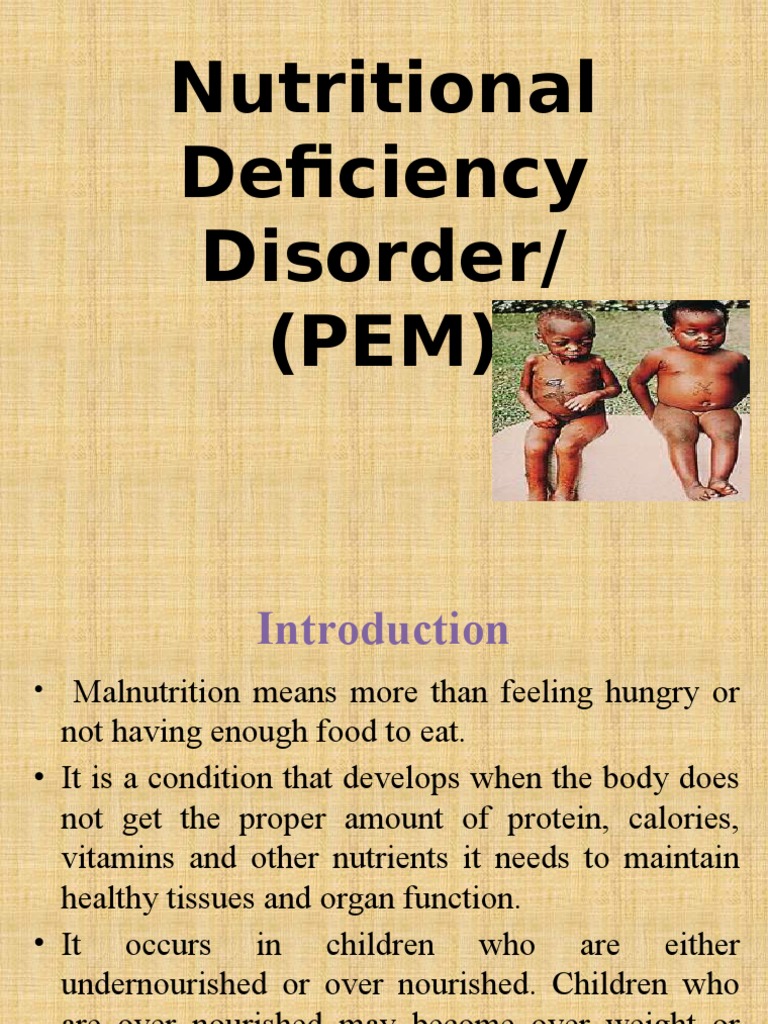 Nutritional Deficiency Disorder/ (PEM) | PDF | Malnutrition | Nutrients