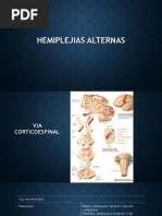 Sindromes Alternos | PDF | Sistema nervioso central | Neurología