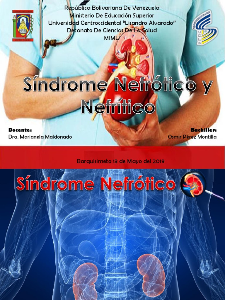 Sindrome Nefrotico y Nefritico Pediatria Mimu | Enfermedades y ...