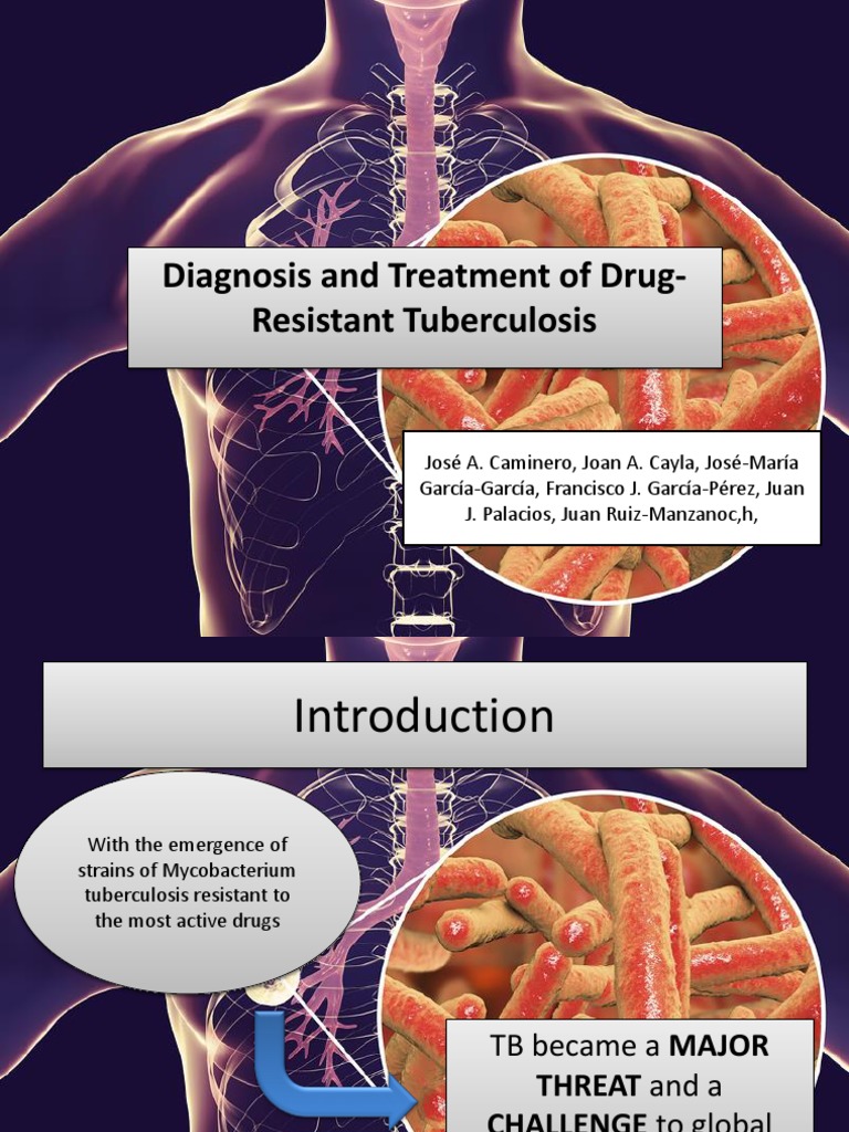 Diagnosis and Treatment of Drug-Resistant Tuberculosis-Hermanto ...
