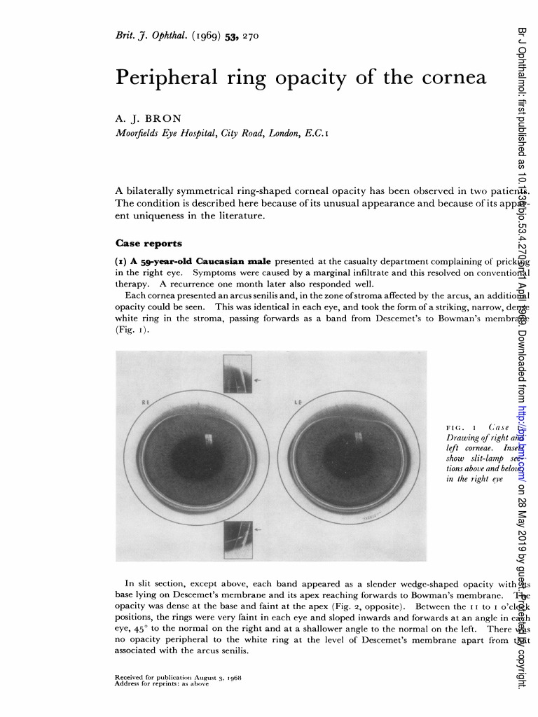 Peripheral Ring Opacity: of The | PDF | Cornea | Ophthalmology