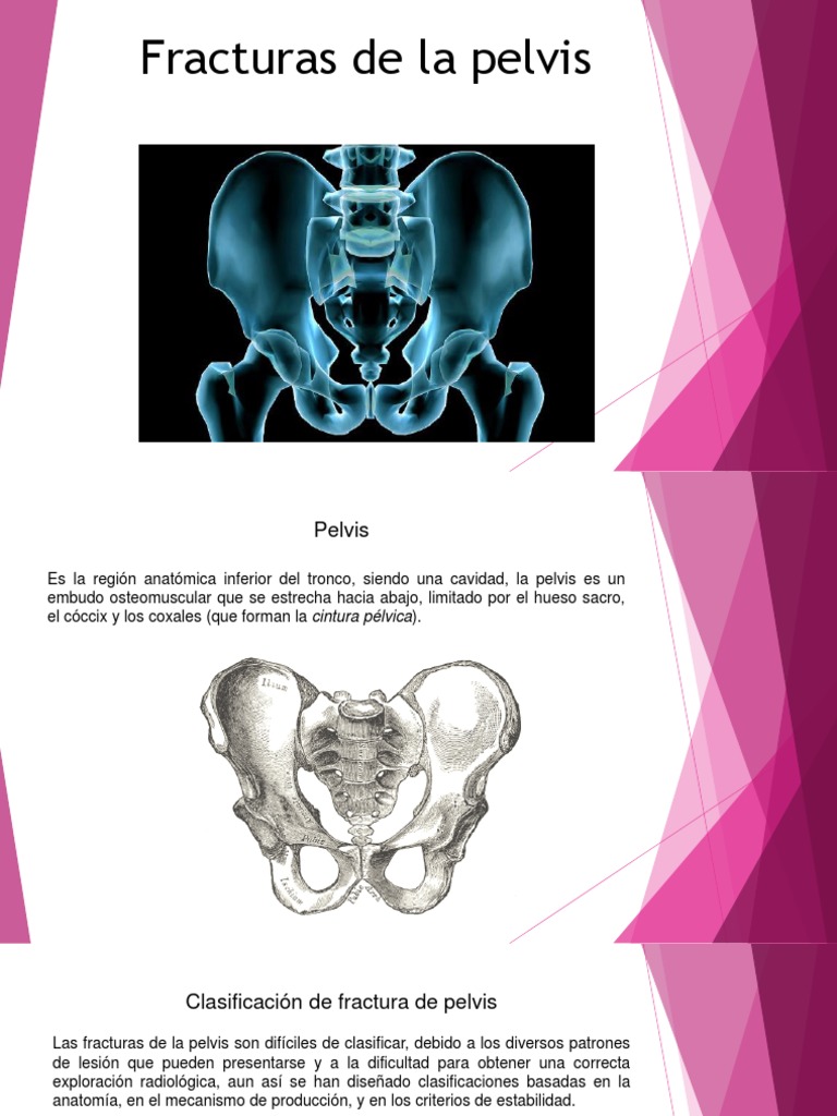 Fracturas de La Pelvis | PDF | Pelvis | Sistema musculoesquelético