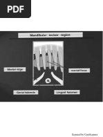 British Standards Incisor Classification: Class I | PDF | Wellness ...