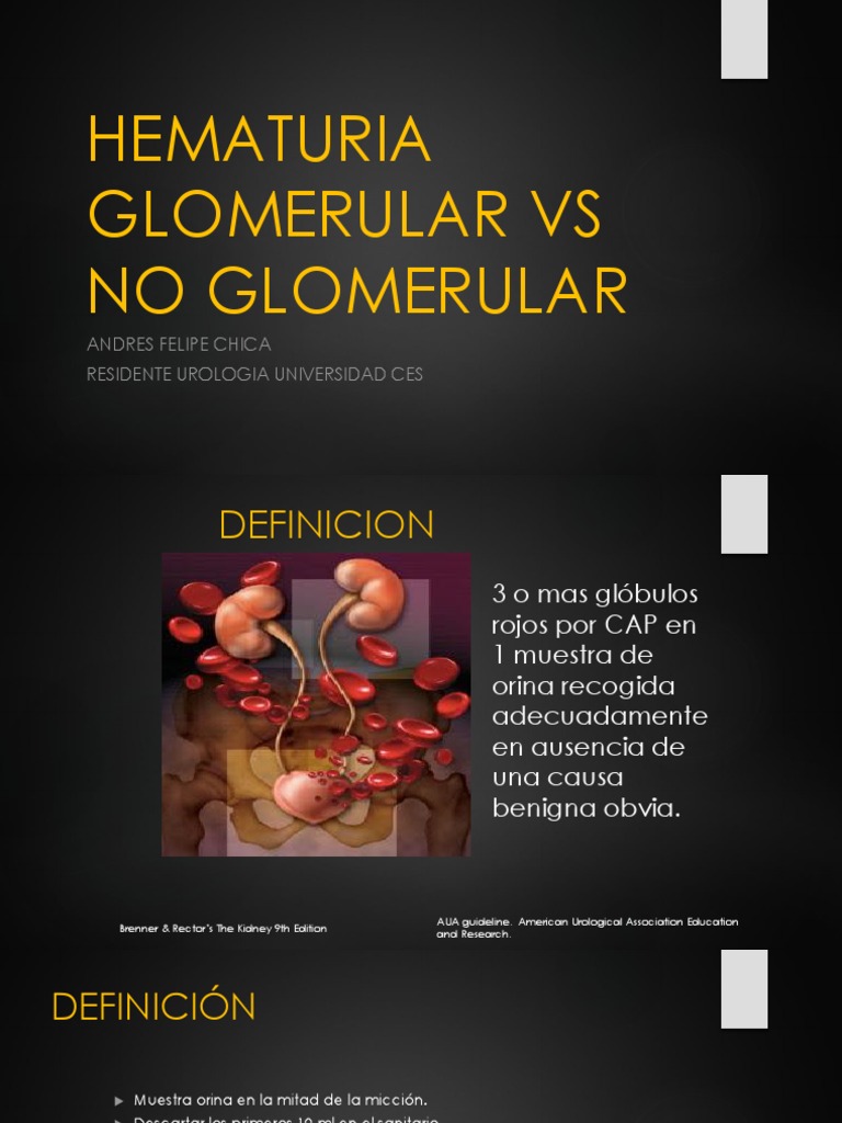Hematuria Glomerular vs No Glomerular | Urología | Riñón