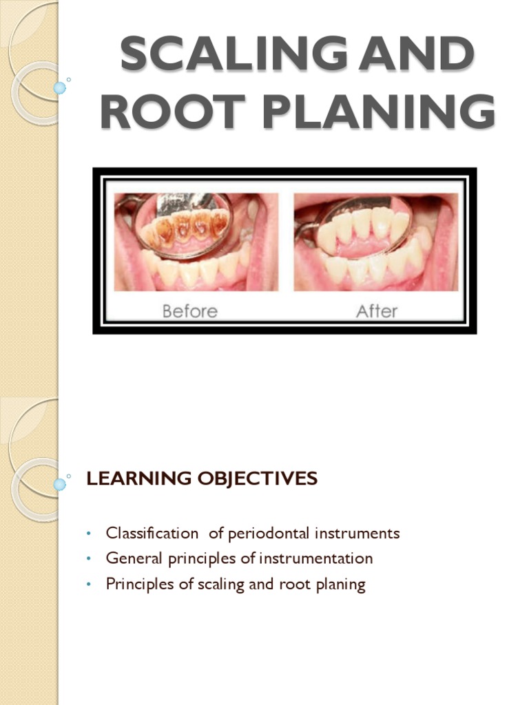 Principles of Scaling and Root Planing | PDF | Mouth | Dentistry