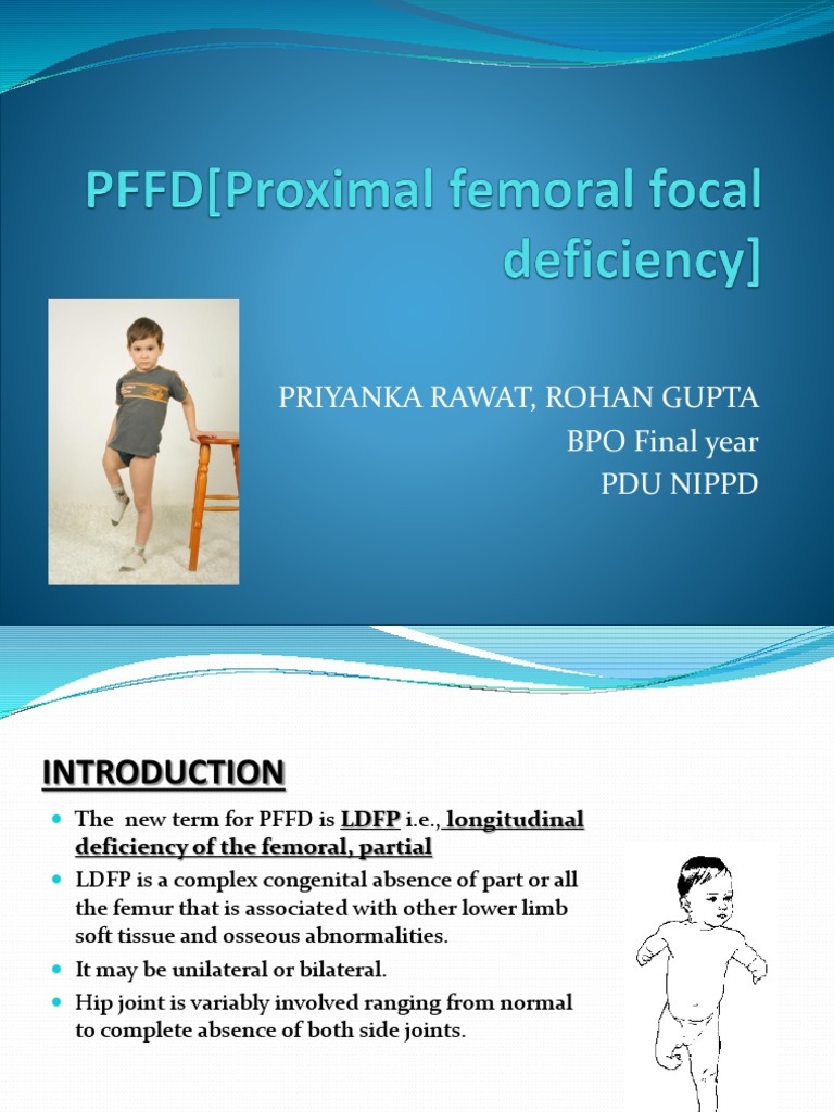 PFFD (Proximal Femoral Focal Deficiency) | PDF | Prosthesis | Human Leg