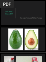 Cortes Transversales y Longitudinales | PDF