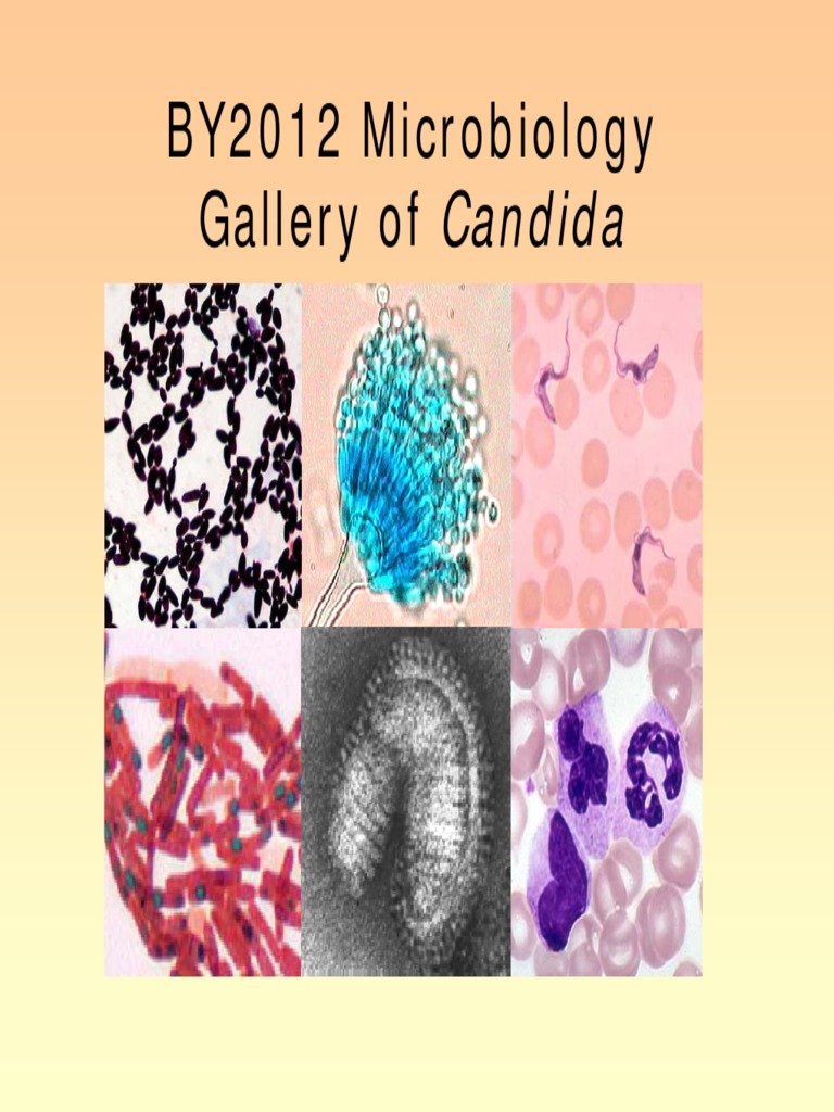 Candida albicans Overview and Diagrams | PDF | Candida (Fungus) | Yeast