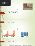 Tipos de Edemas | PDF | Edema | Medicina