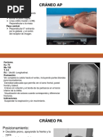Proyección Hirtz para Cráneo | PDF