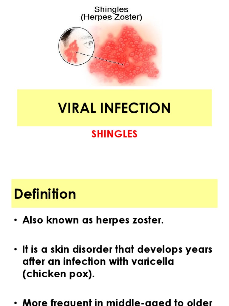 Viral Infection | PDF