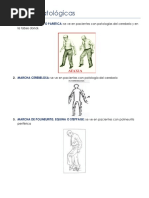 Prueba de Adams | PDF | La columna vertebral | Escoliosis