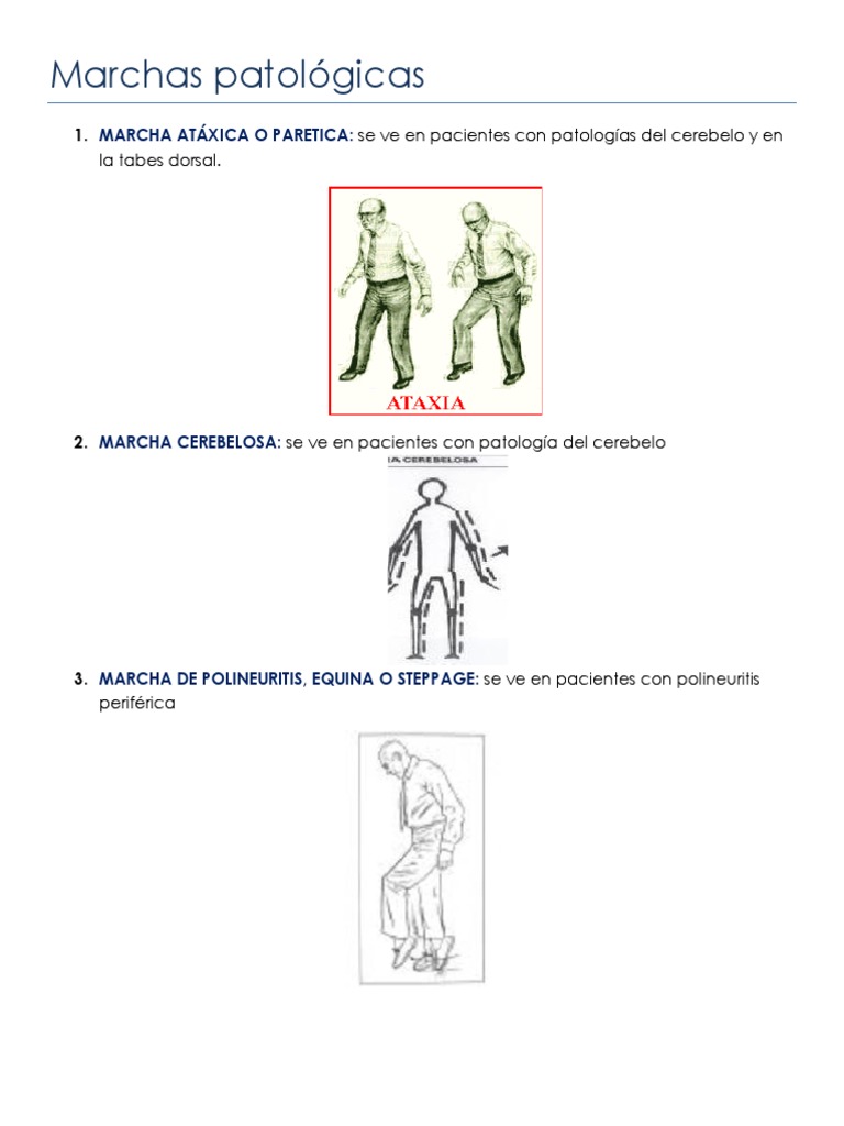 Marchas patológicas: Marcha Atáxica O Paretica | Pie | Rodilla