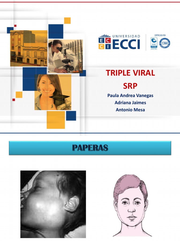 Vacuna Triple Viral | PDF | Sarampión | Inmunología