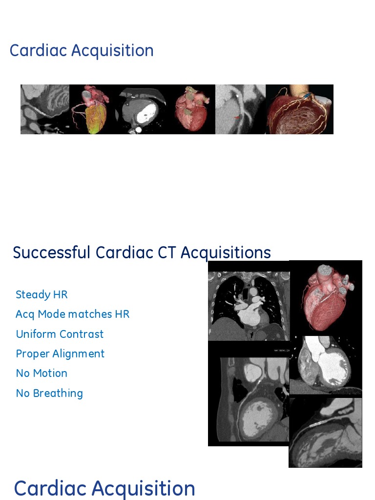 Cardiac CT Acquisition Modes | PDF | Ct Scan | Heart