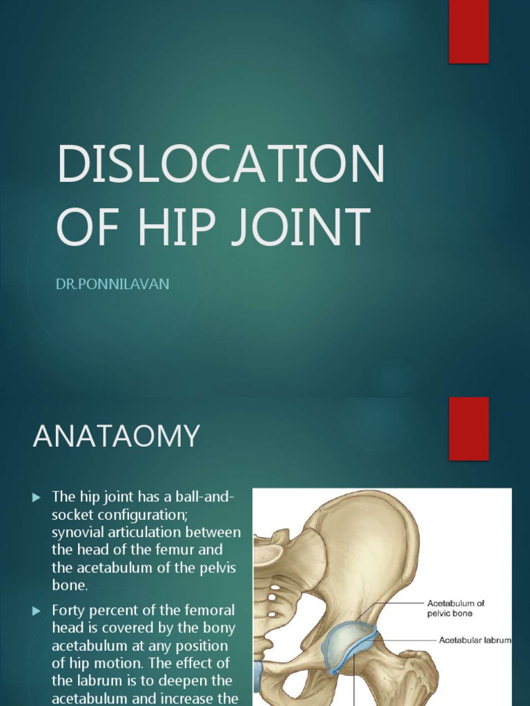 Dislocation of Hip Joint: DR - Ponnilavan | PDF | Hip | Anatomical ...