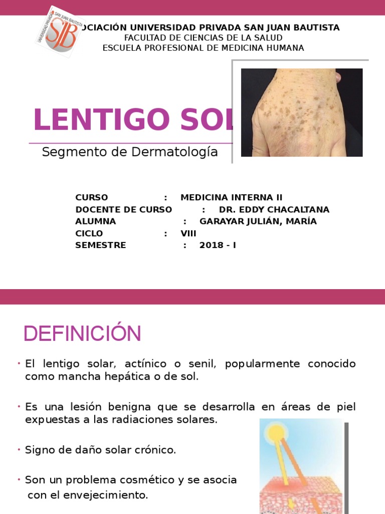 Lentigo Solar | PDF | Ultravioleta | Melanoma